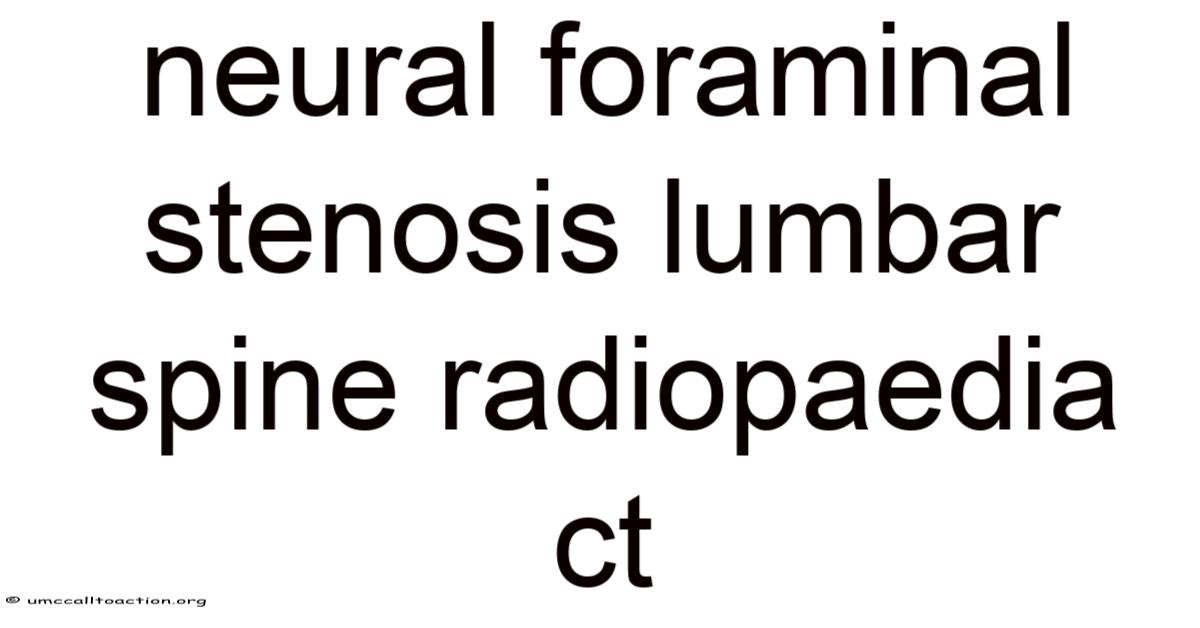 Neural Foraminal Stenosis Lumbar Spine Radiopaedia Ct